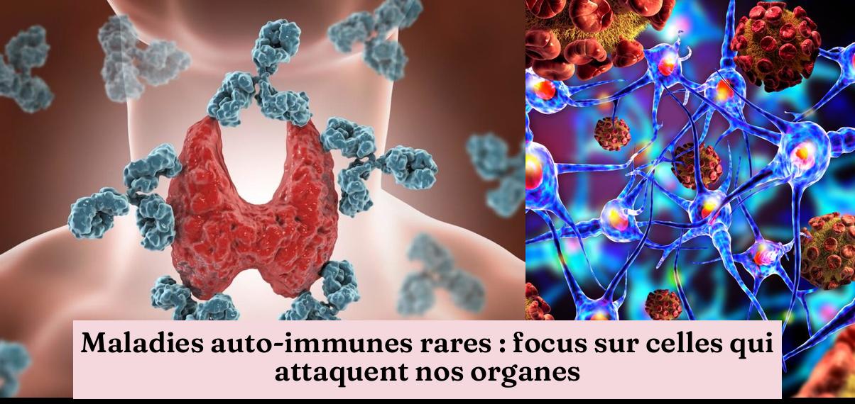 Maladies auto-immunes rares : focus sur celles qui attaquent nos ...