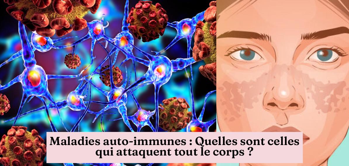 Maladies auto-immunes : Quelles sont celles qui attaquent tout le corps ...